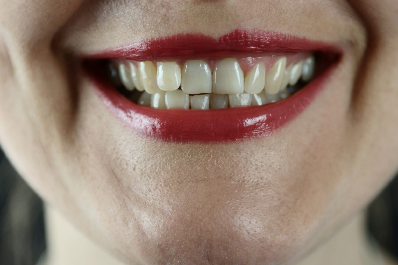 Does a B1 Tooth Shade Always Indicate Healthy Teeth? - BuzzManchester